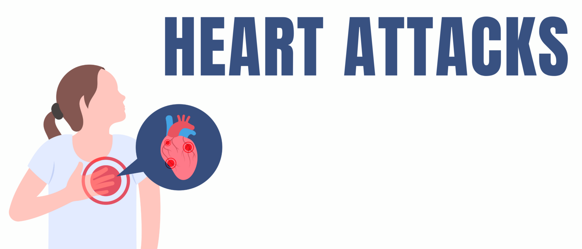 Heart Attacks - Fort HealthCare